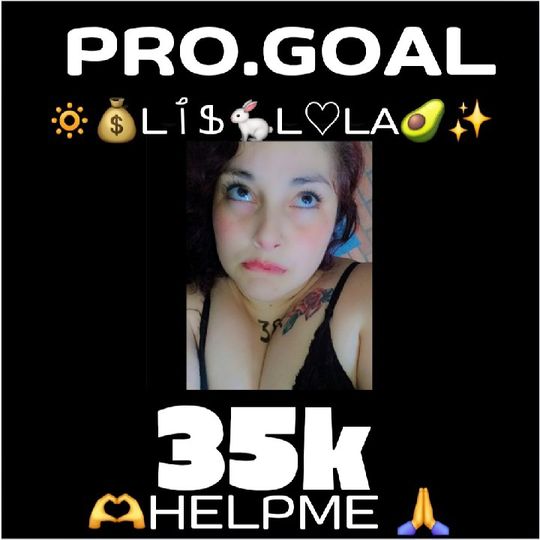 🔅LIS🐇L♡LA ️ ️‍🩹 liveme.com